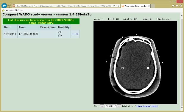 Conquest DICOM software